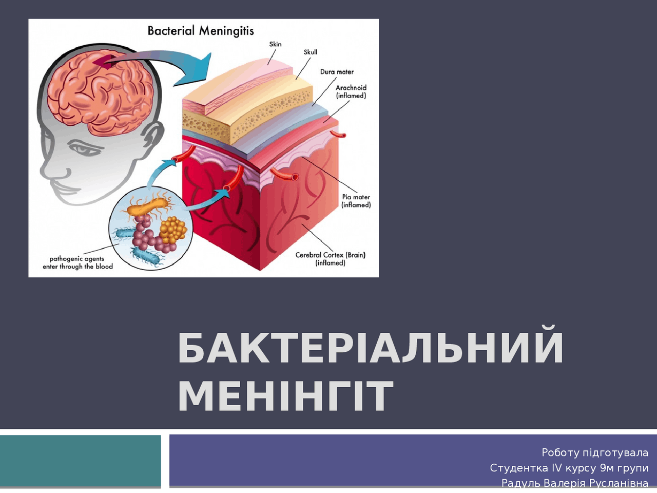 бактеріальний менінгіт Презентации Неврология Docsity