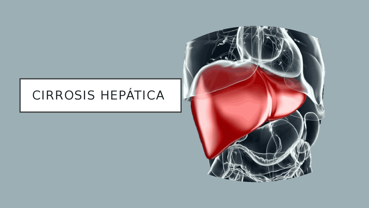Cirrosis hepática Cirrosis hepática se refiere a la cicatrización del ...