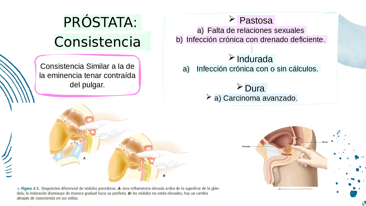 ¿Qué es la próstata? La próstata es una parte del aparato reproductor ...