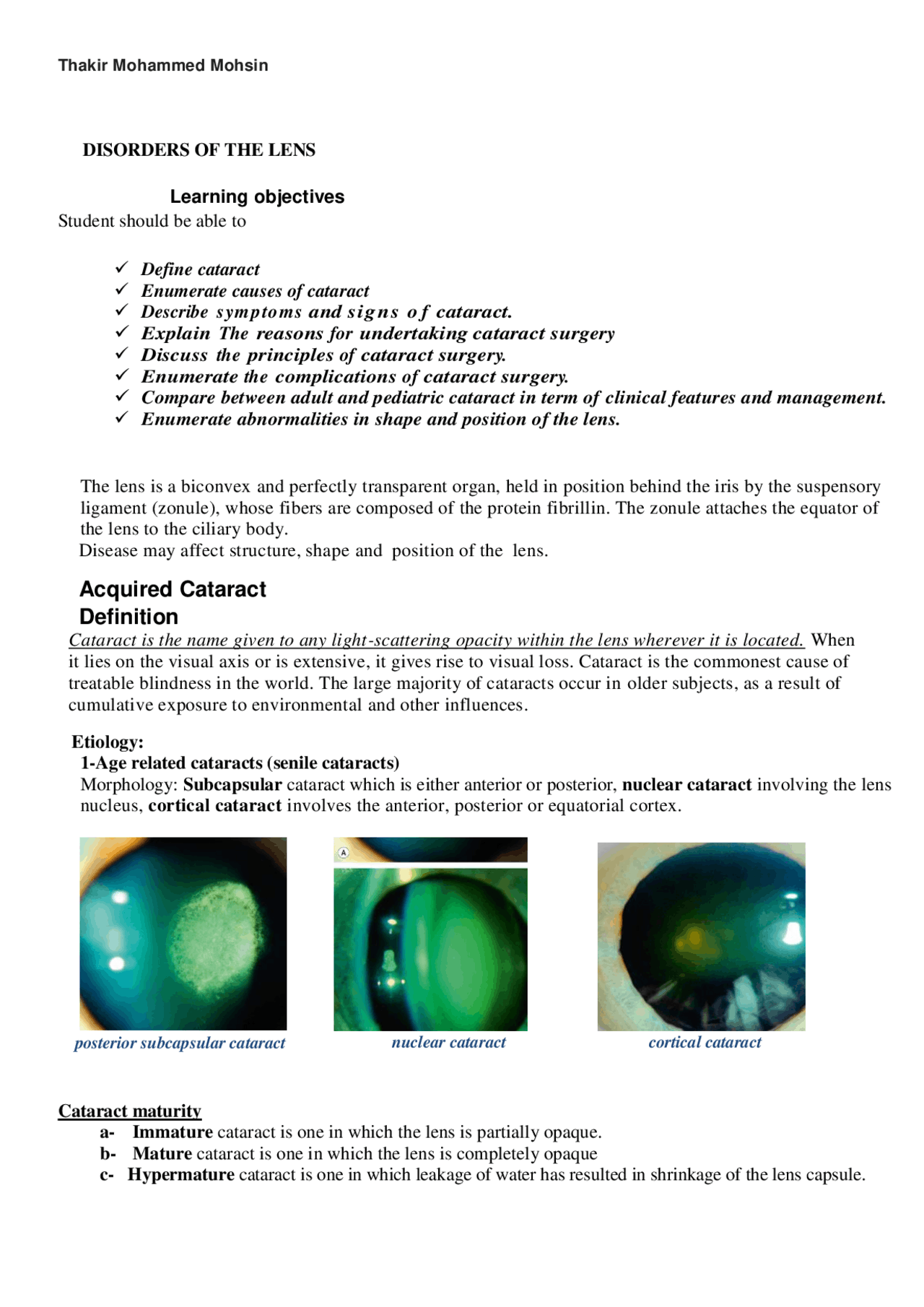 Disorders of the Lens | Study notes Pathology | Docsity