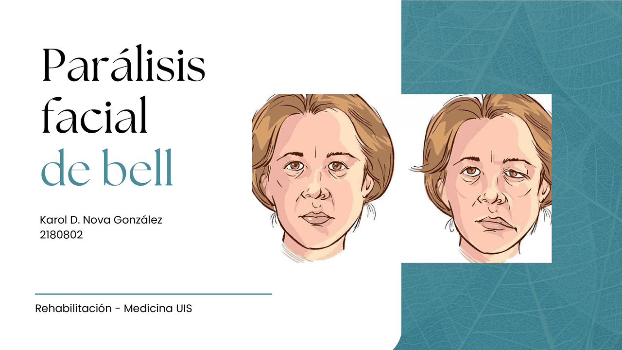 Parálisis de bell - Revisión de tema y rehabilitación. | Diapositivas ...