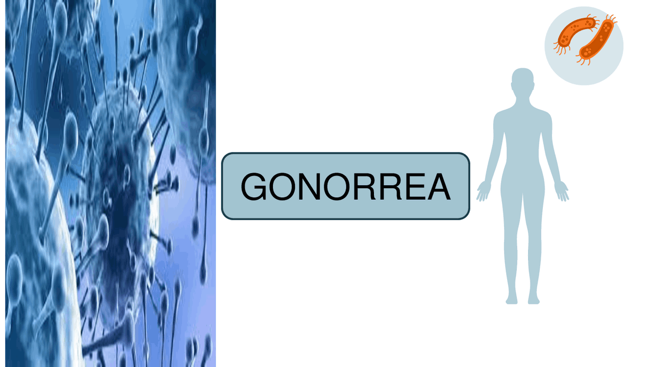 Info gonorrea donde viene una amplia información | Esquemas y mapas ...