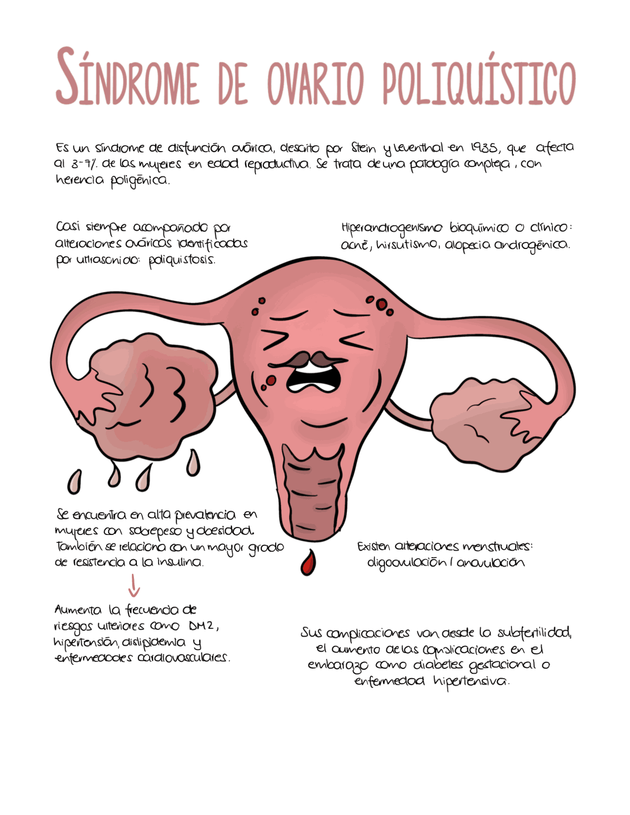 SOP (sindrome de ovario poliquístico) (ilustrado) | Diapositivas de ...