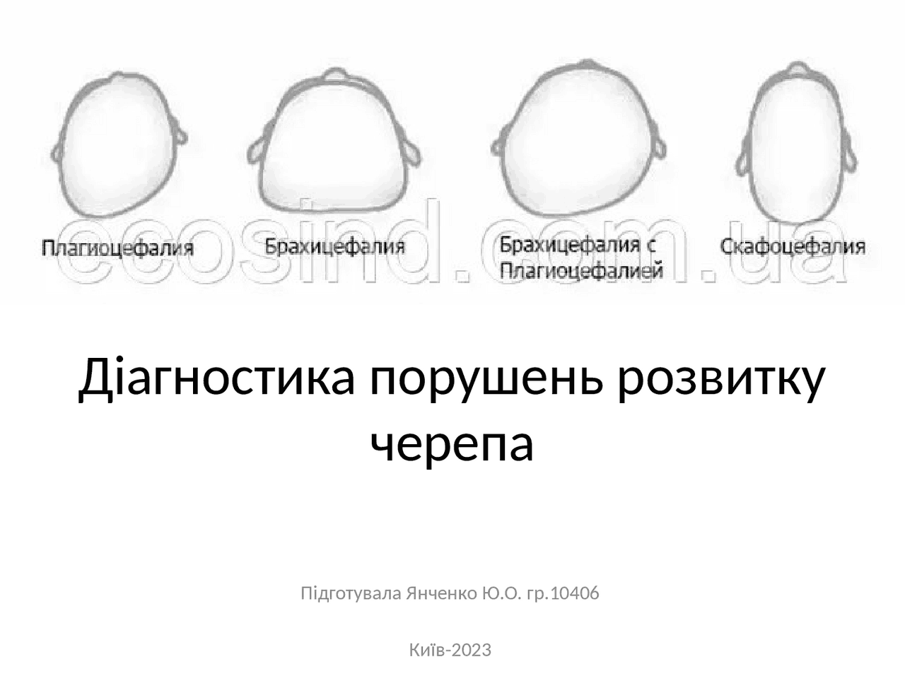 Діагностика порушень розвитку черепа Презентации Радиология Docsity