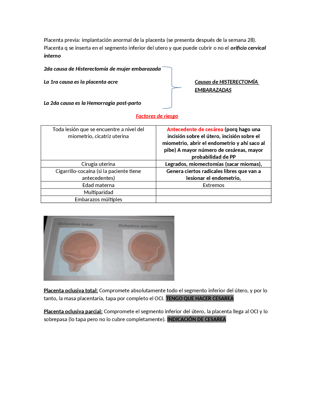 Placenta Previa Tocogineco Esquemas Y Mapas Conceptuales De