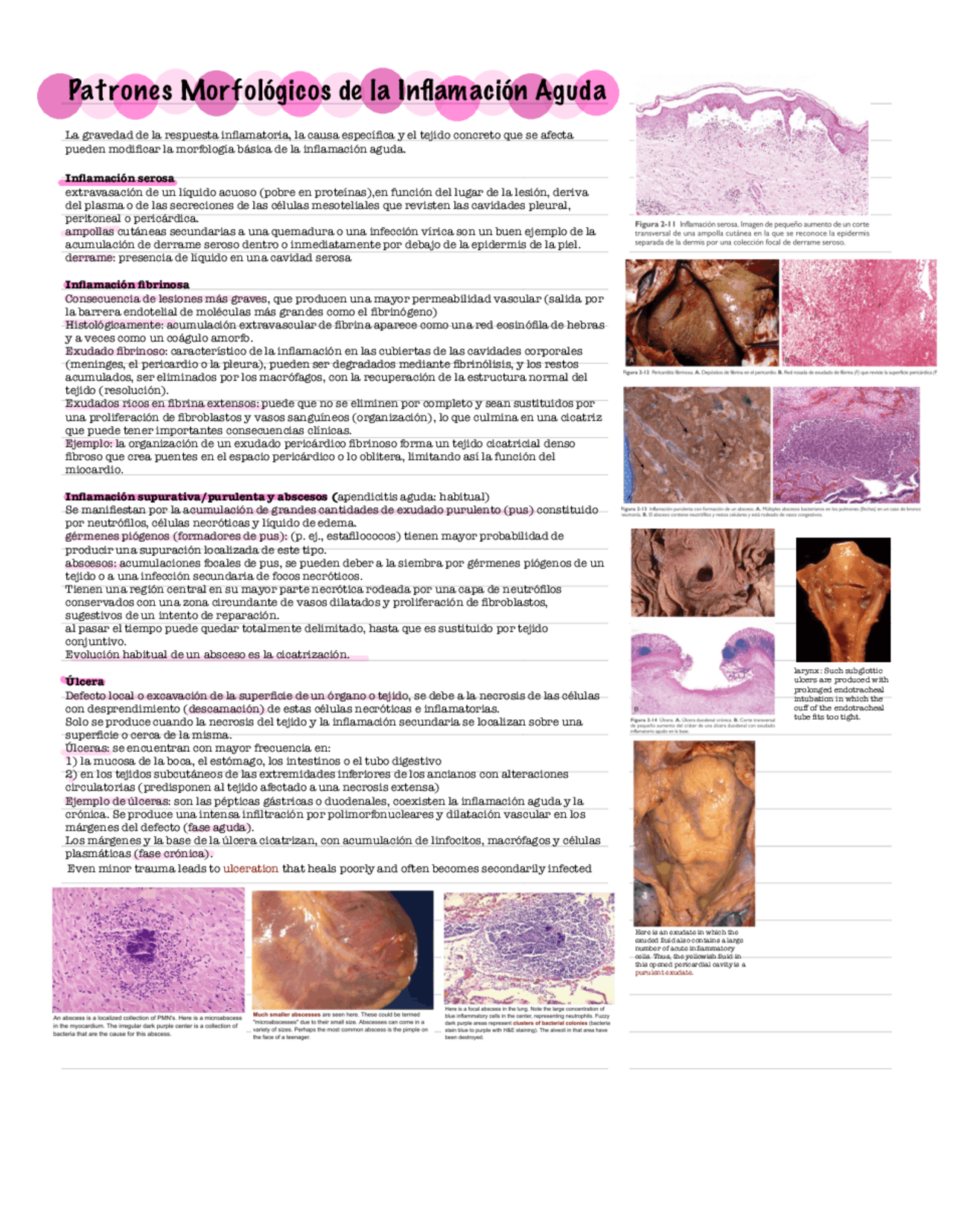 Patrones morfológicos de la inflamación aguda | Apuntes de Patología ...