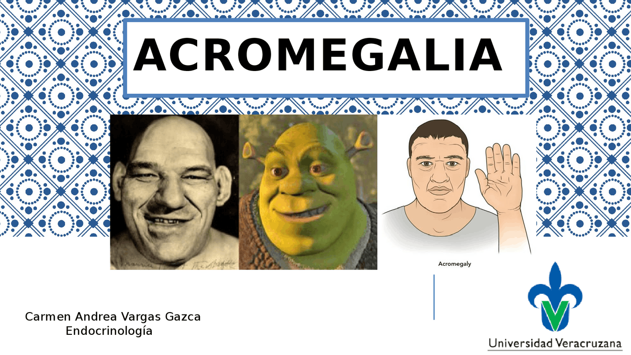Acromegalia: diagnóstico y tratamiento | Esquemas y mapas conceptuales ...