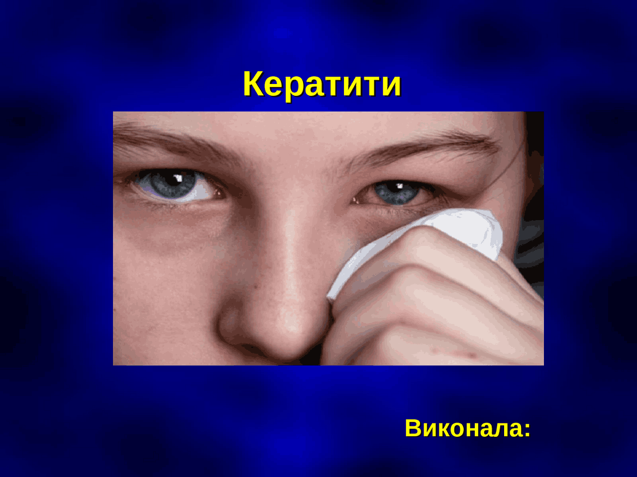 Презентація кератит Презентации Офтальмология Docsity
