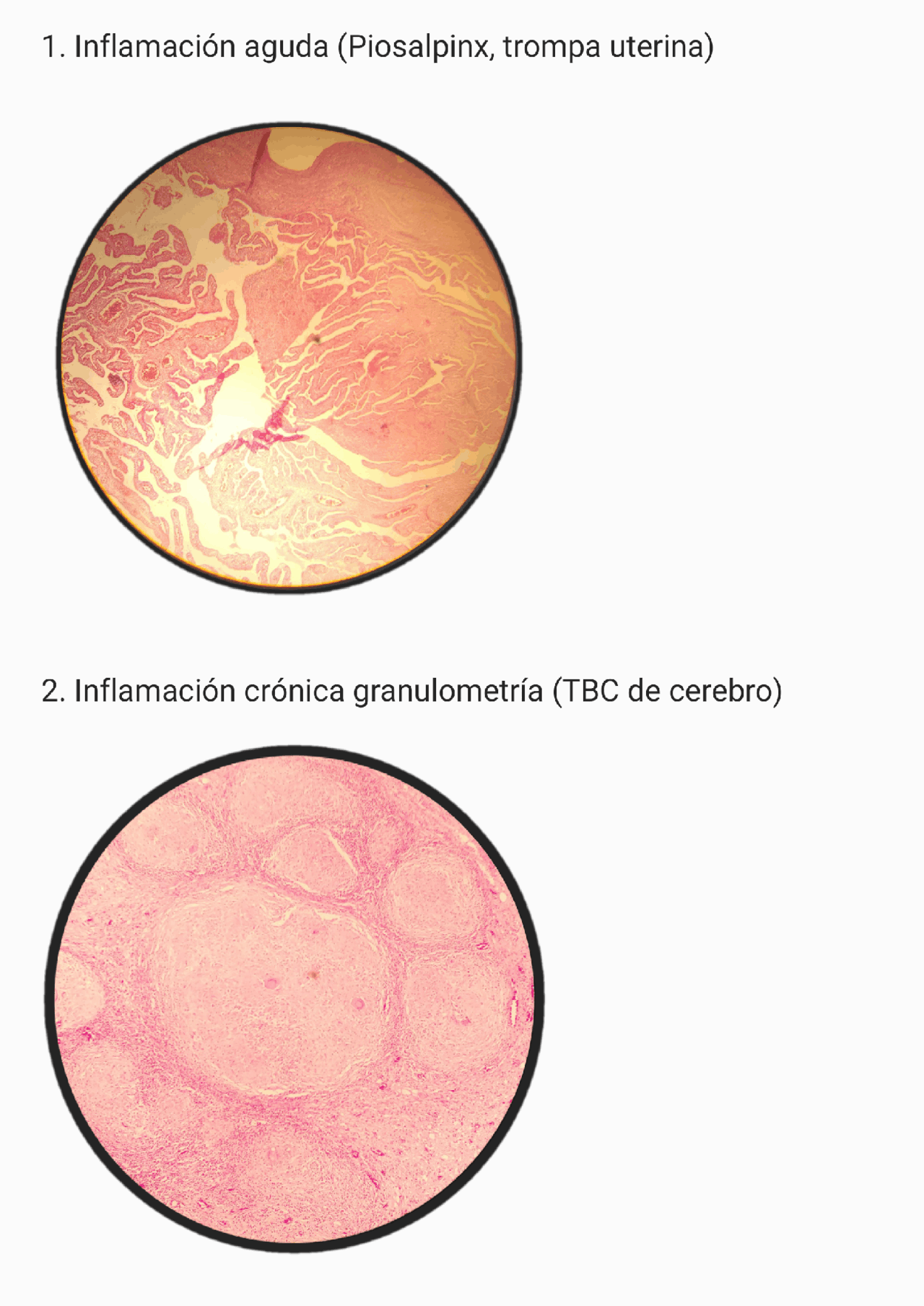 Lista de placas de antomia patologica | Appunti di Anatomia Patologica ...