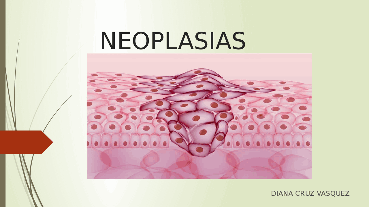 que son las neoplasias | Diapositivas de Fisiopatología | Docsity
