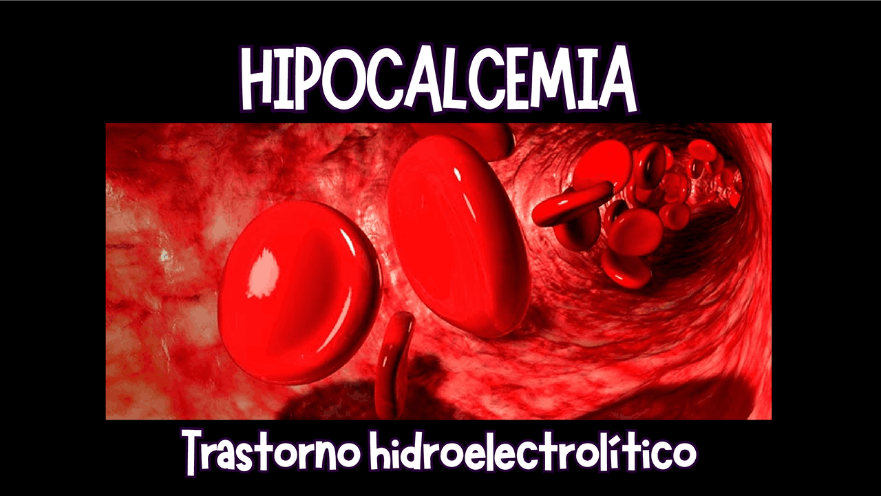 Hipocalcemia: Causas, Síntomas y Tratamiento | Esquemas y mapas ...