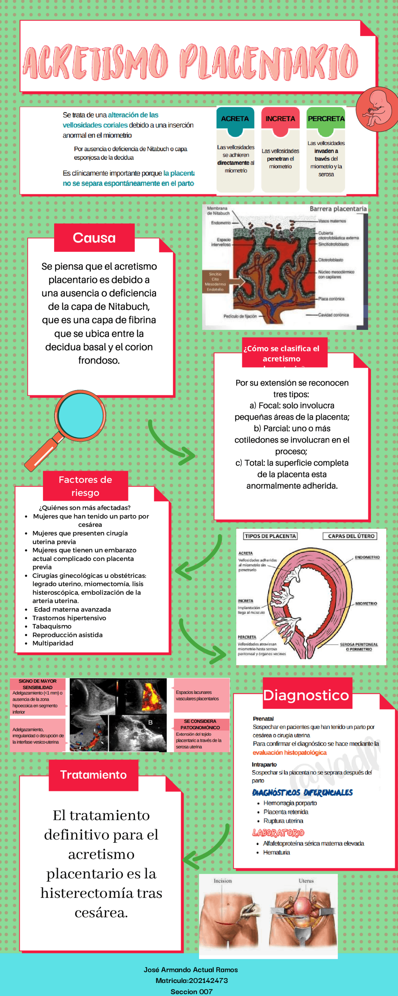 Acretismo placentario | Esquemas y mapas conceptuales de Patología ...