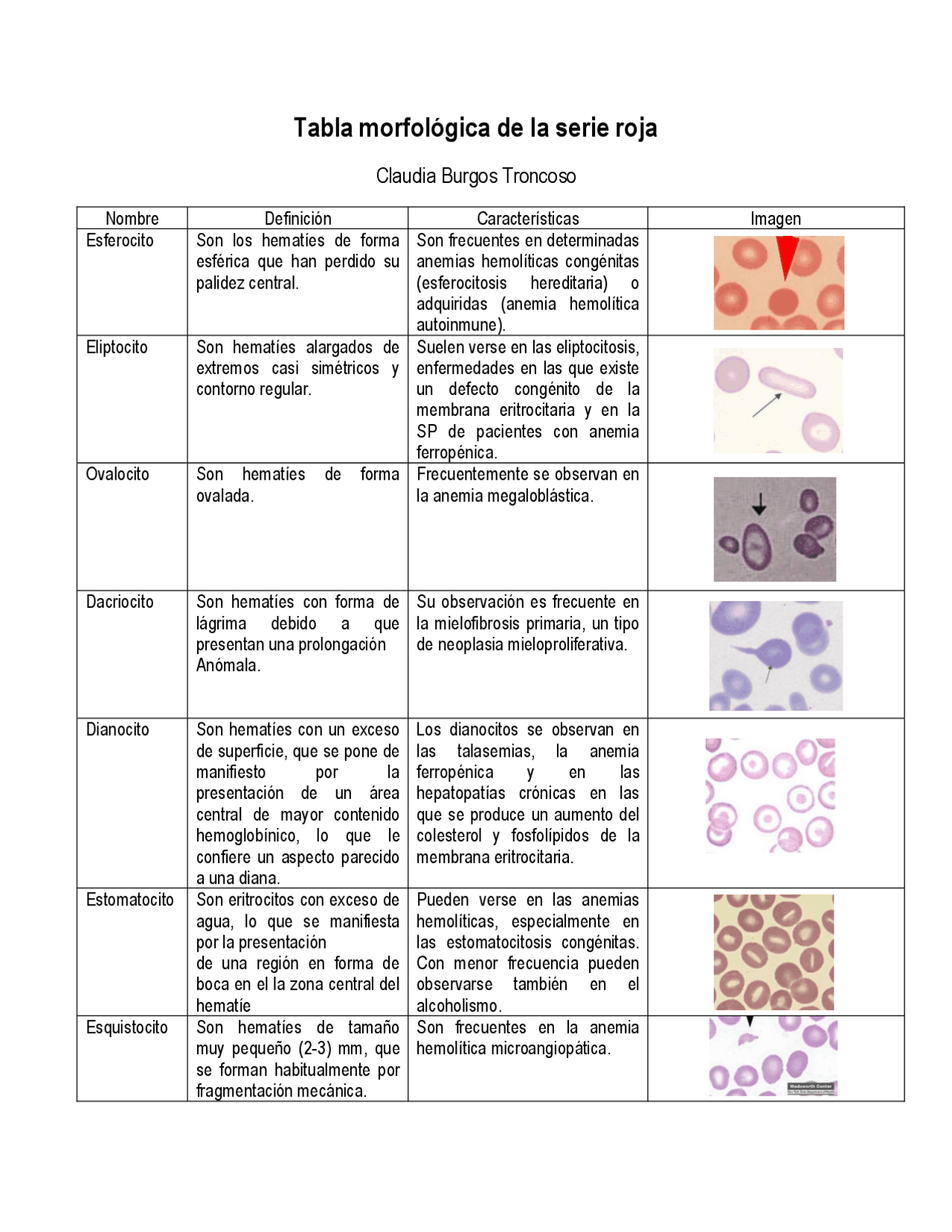 alteraciones morfologicas de la serie roja | Esquemas y mapas ...