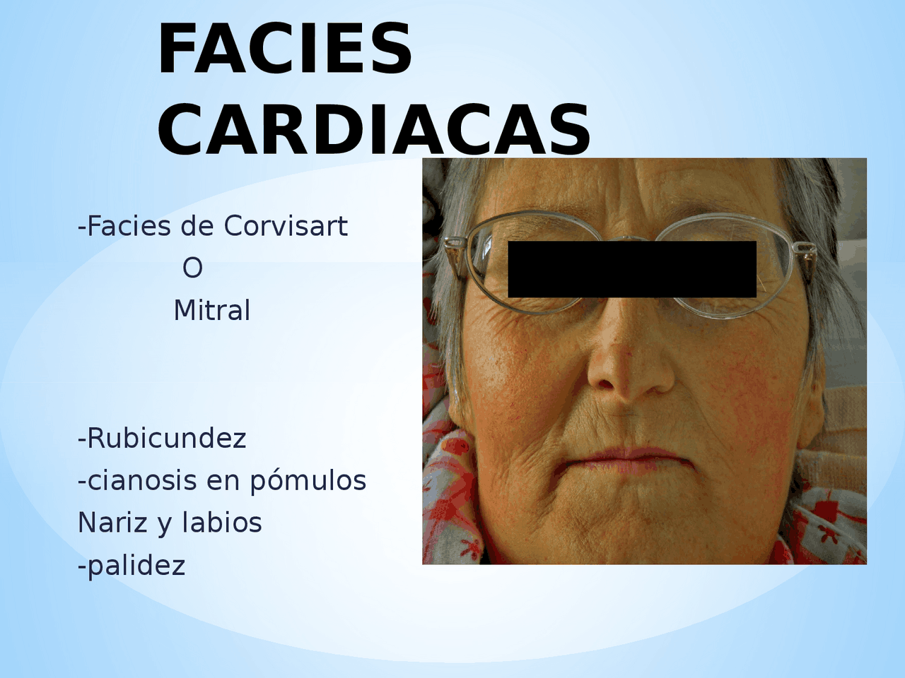 facies cardiacas como se va manifestando, como podemos realozar un ...