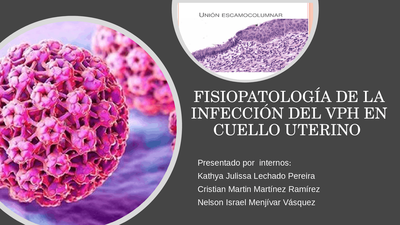 VPH y su relacion al cancer de cervix | Diapositivas de Oncología | Docsity