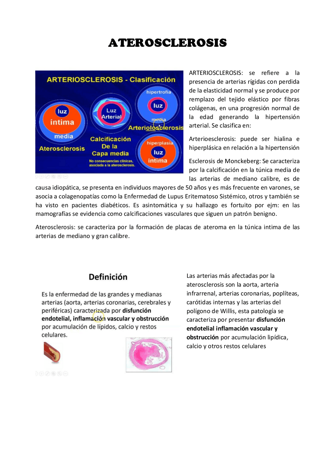 Arterioesclerosis Hiperplásica