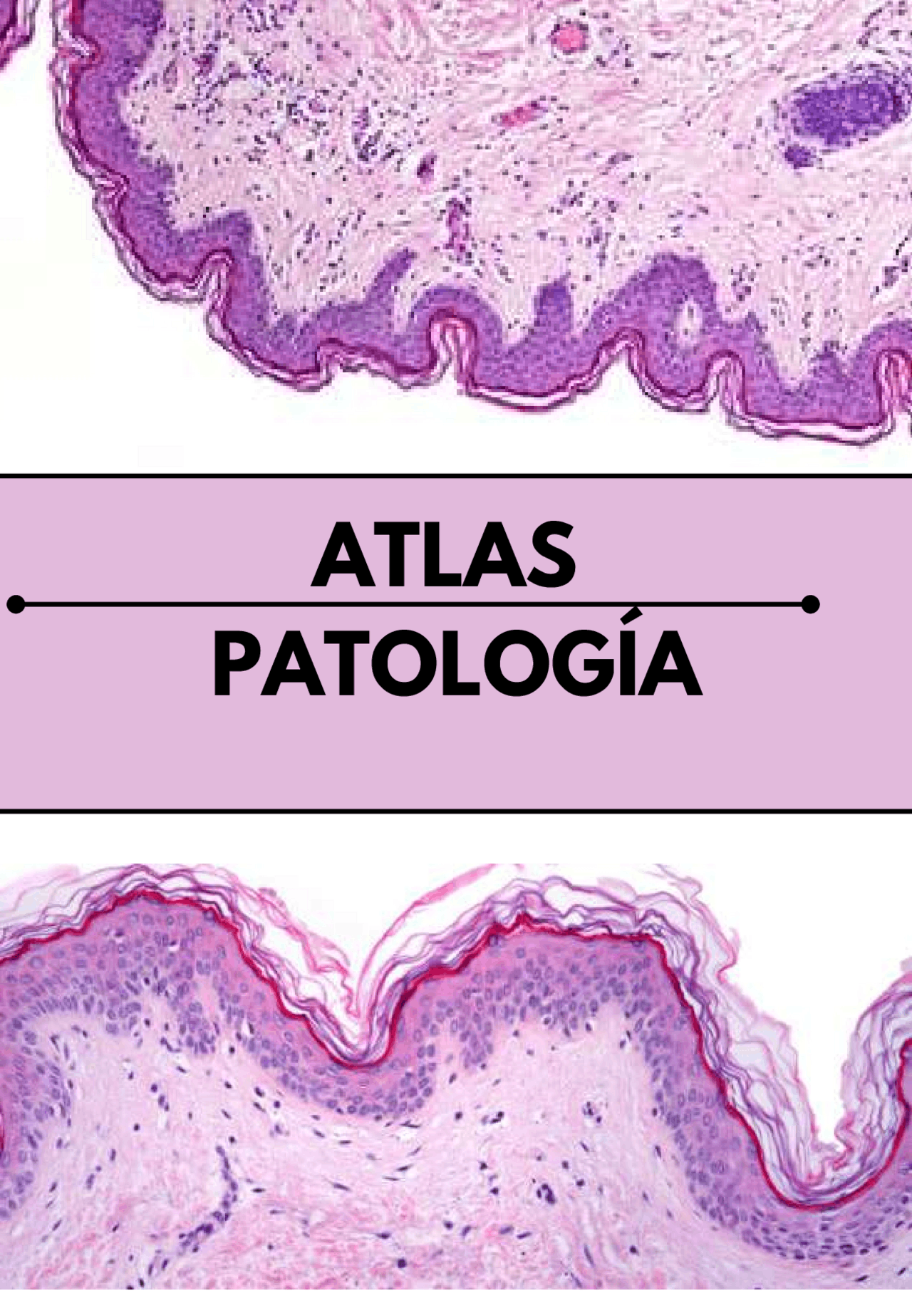 Atlas De Patología I | Apuntes de Patología | Docsity