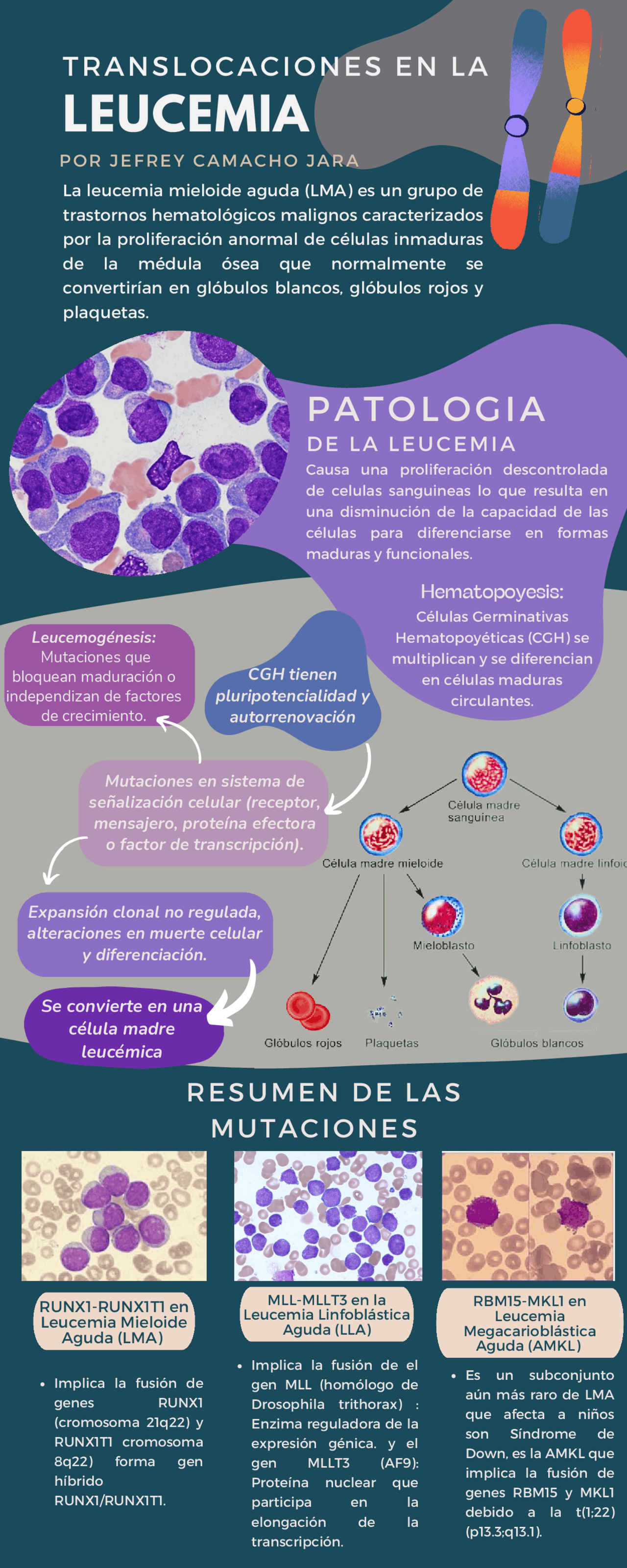 Translocaciones en la leucemia mieloide aguda | Esquemas y mapas ...