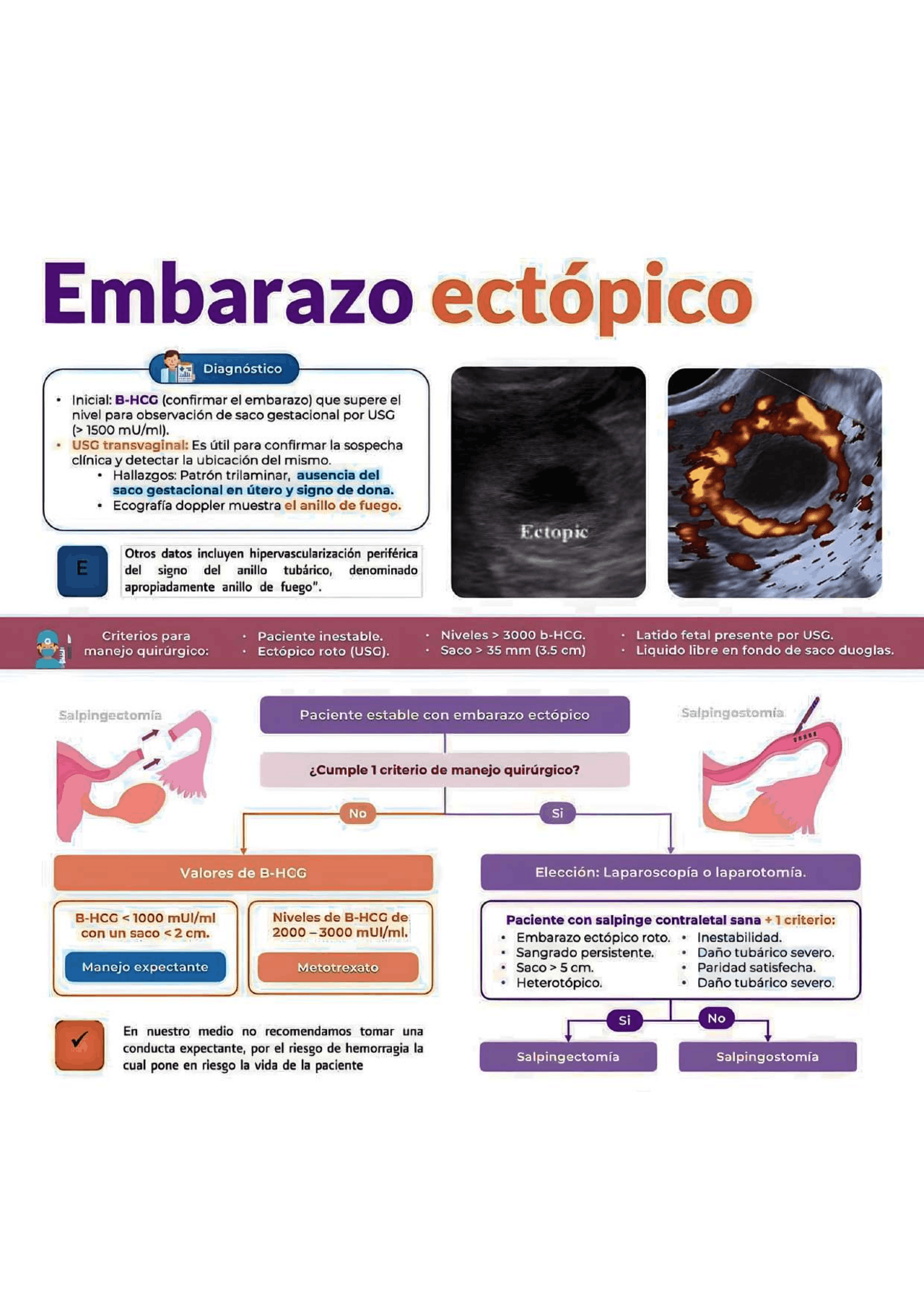 Embarazo Ectopico Flashcards Apuntes De Ginecología Docsity