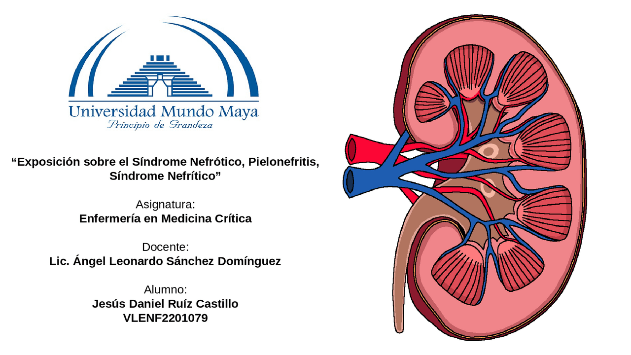 Sindrome nefrotico y nefritico | Diapositivas de Medicina | Docsity