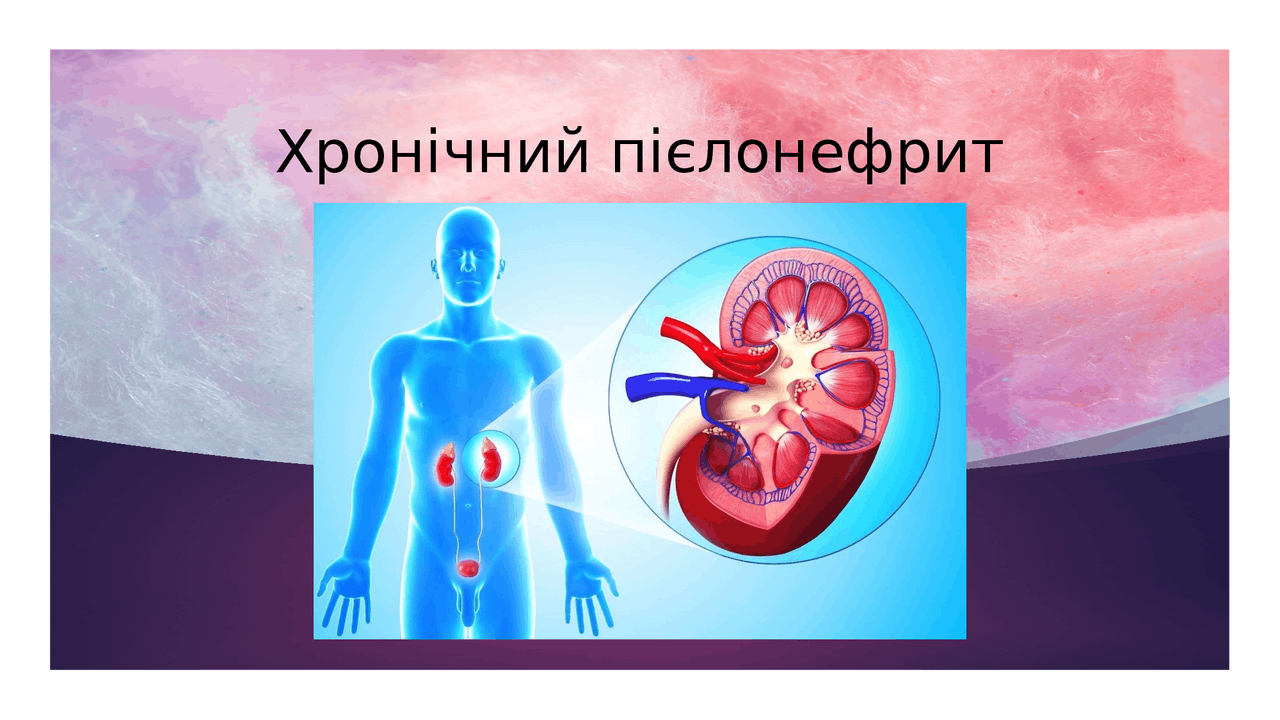 презентації терапія 5 курс Презентации Терапия Docsity