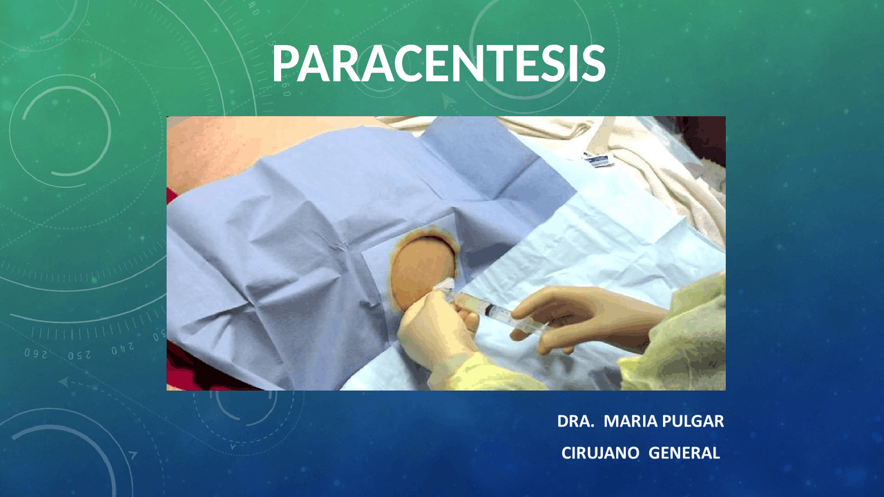 Paracentesis y como realizarla | Diapositivas de Medicina | Docsity