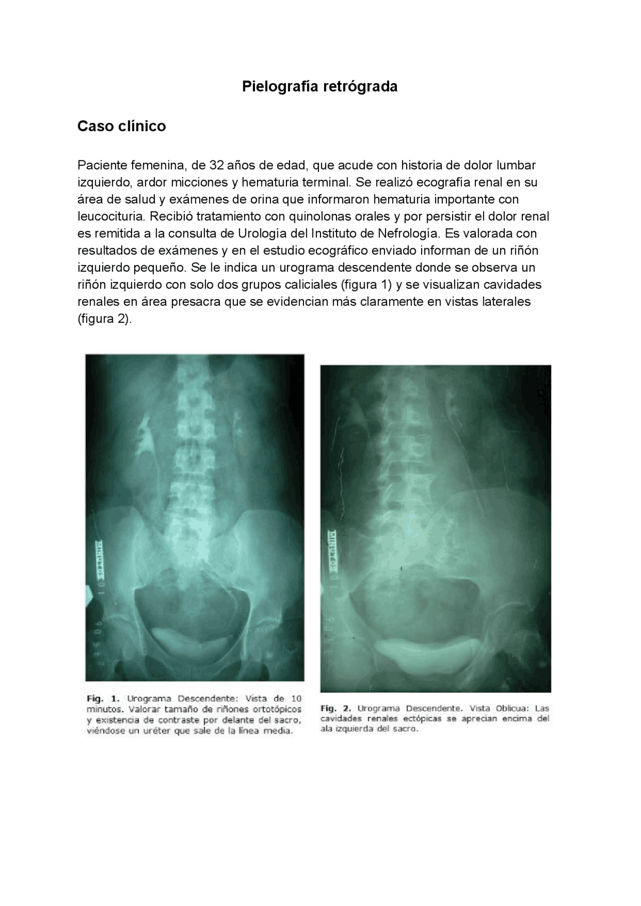 Pielografia retrogrda | Resúmenes de Imagenología | Docsity