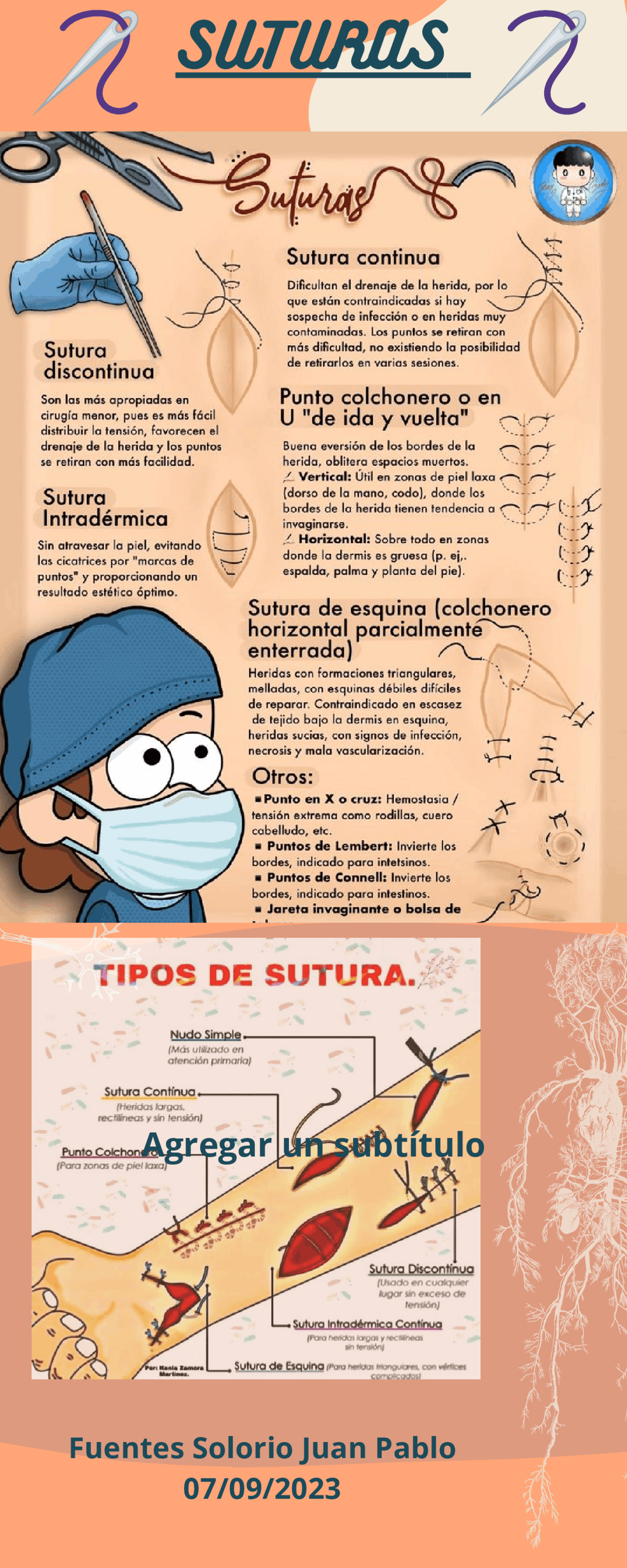 Tipos De Sutura Para La Hora De Quirofano Diapositivas De Enfermería