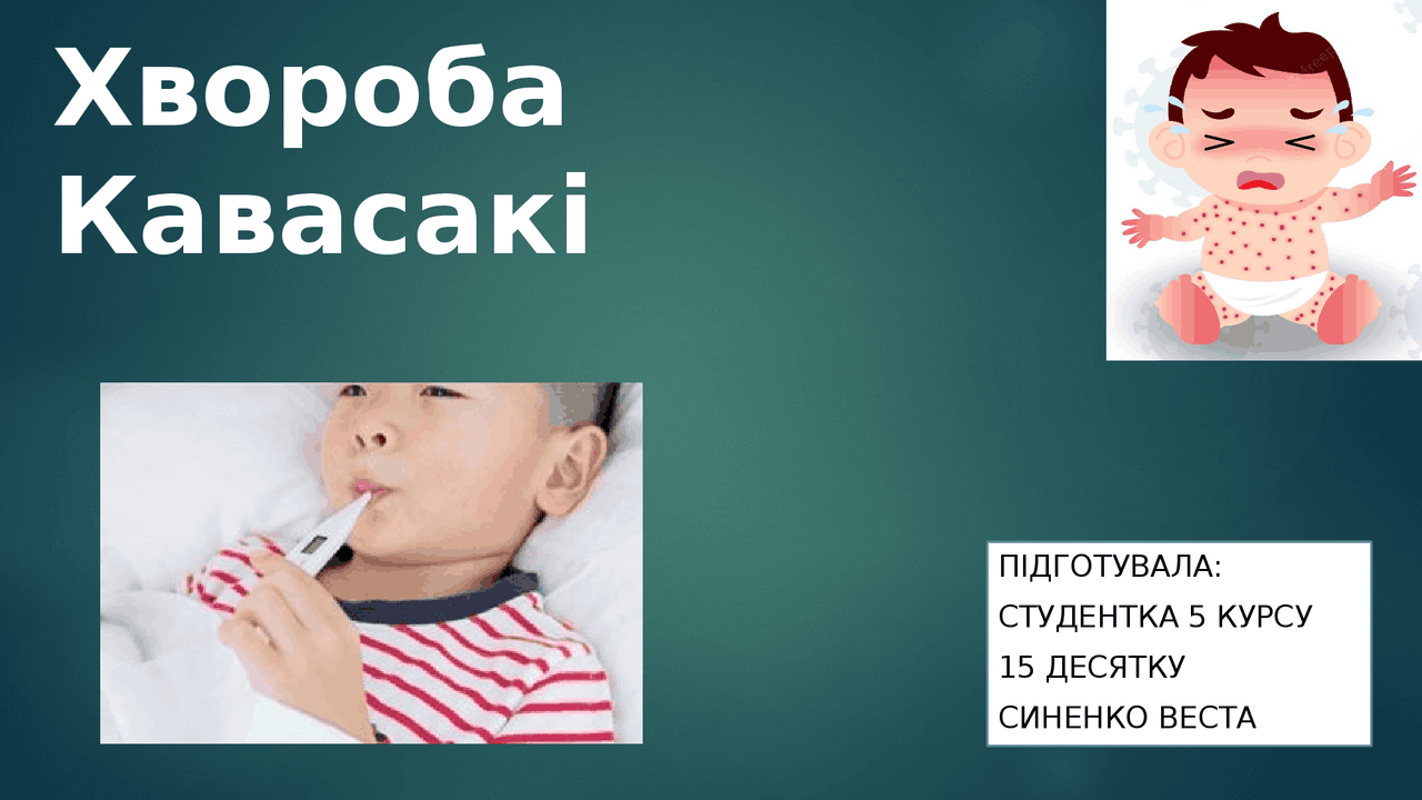 Презентація на тему Хвороба Кавасакі Презентации Терапия Docsity