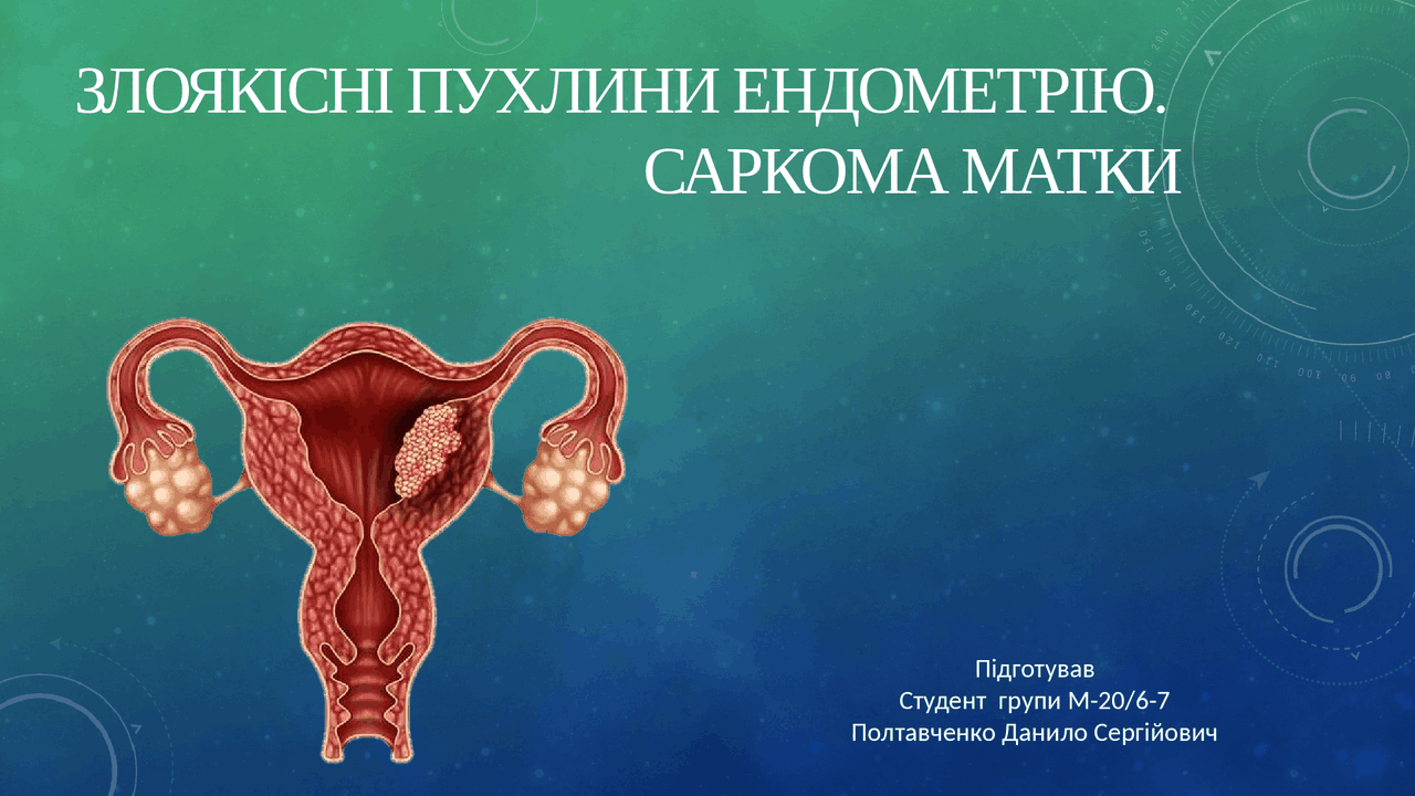 РАК ЕНДОМЕТРІЮ РАК ЕНДОМЕТРІЮ ПРЕЗЕНТАЦІЯ Презентации Гинекология