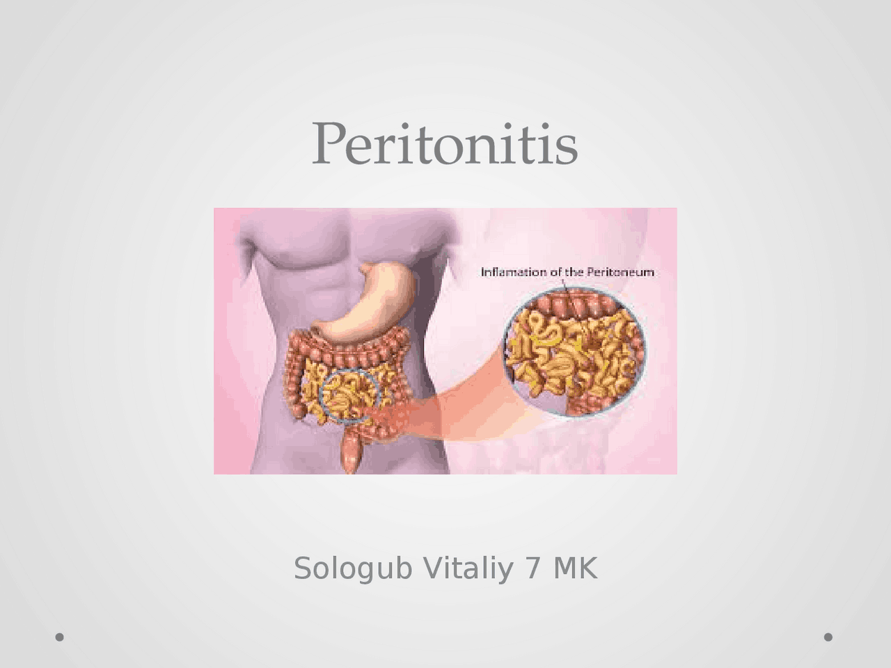 Peritonitis Presentation | Презентации Английский язык | Docsity