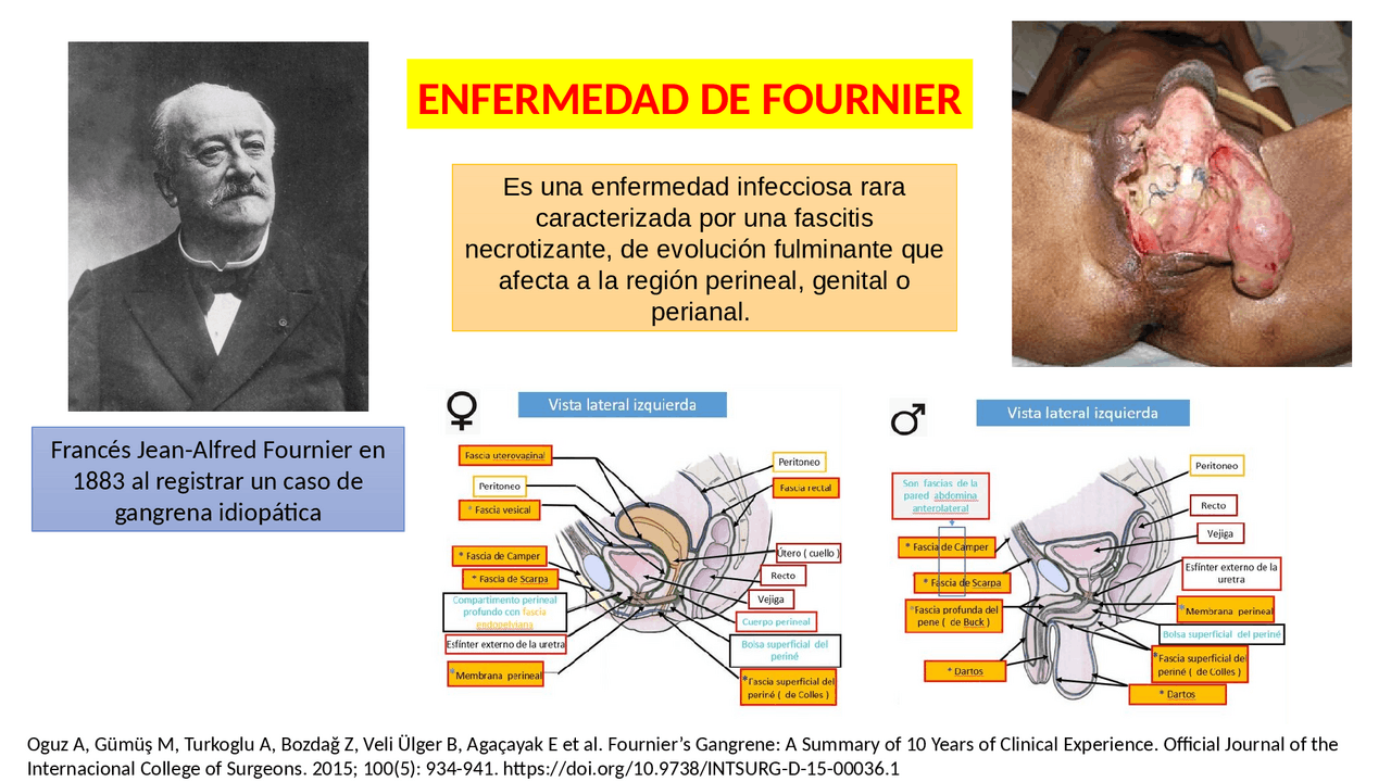 Fournier Enfermedad La Dermatitis Atópica Es Una Enfermedad