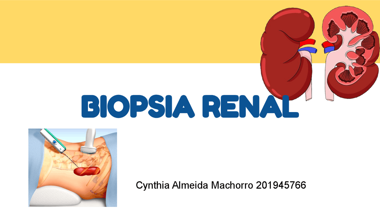 Biopsia renal indicaciones | Diapositivas de Nefrología | Docsity