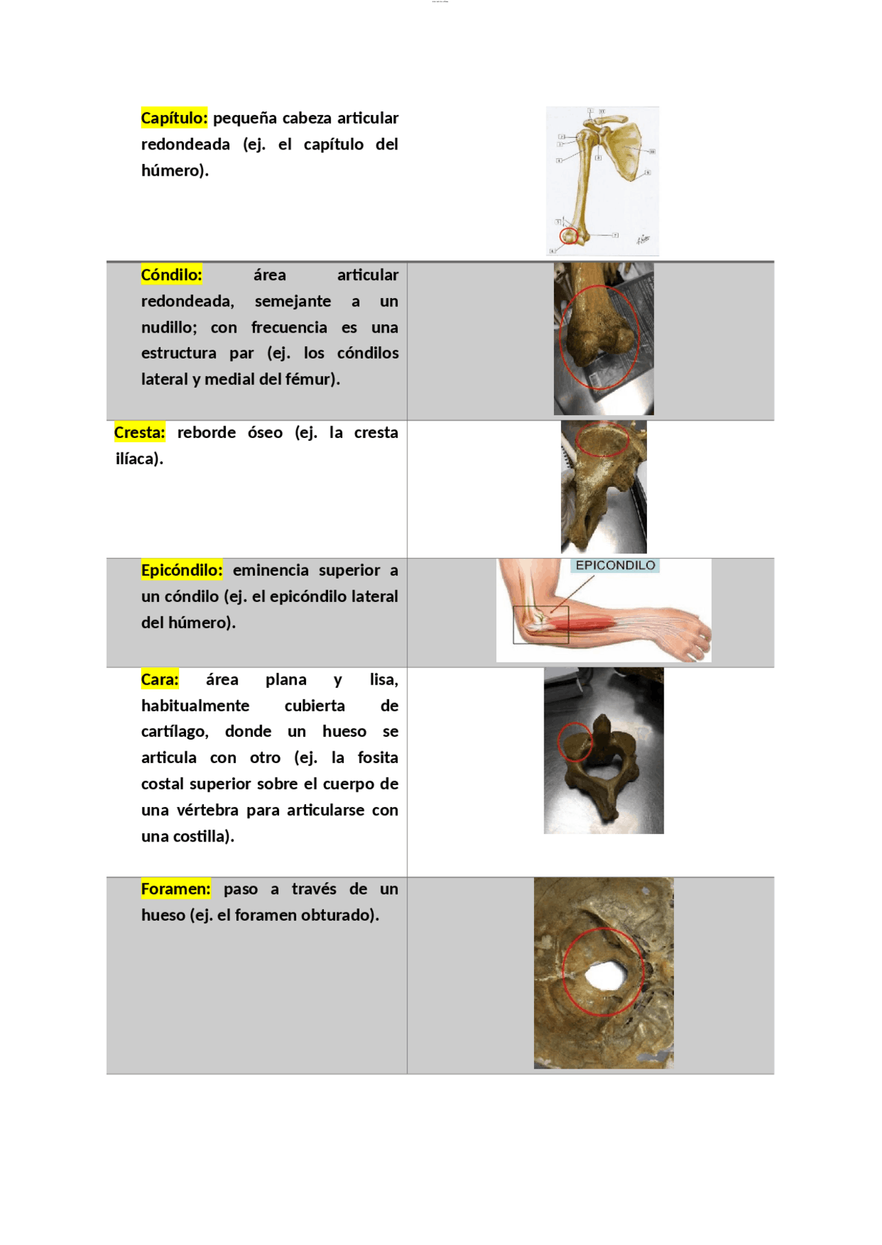 Accidentes óseos Más Comunes Apuntes De Anatomía Docsity