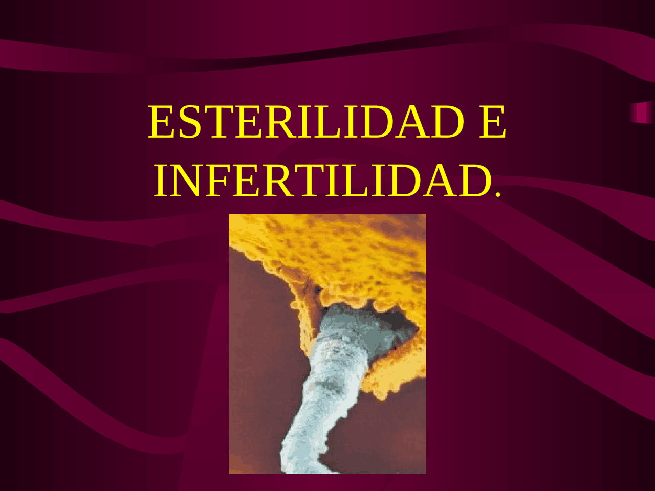 Documento Powert Point Diapositivas De Ginecología Docsity