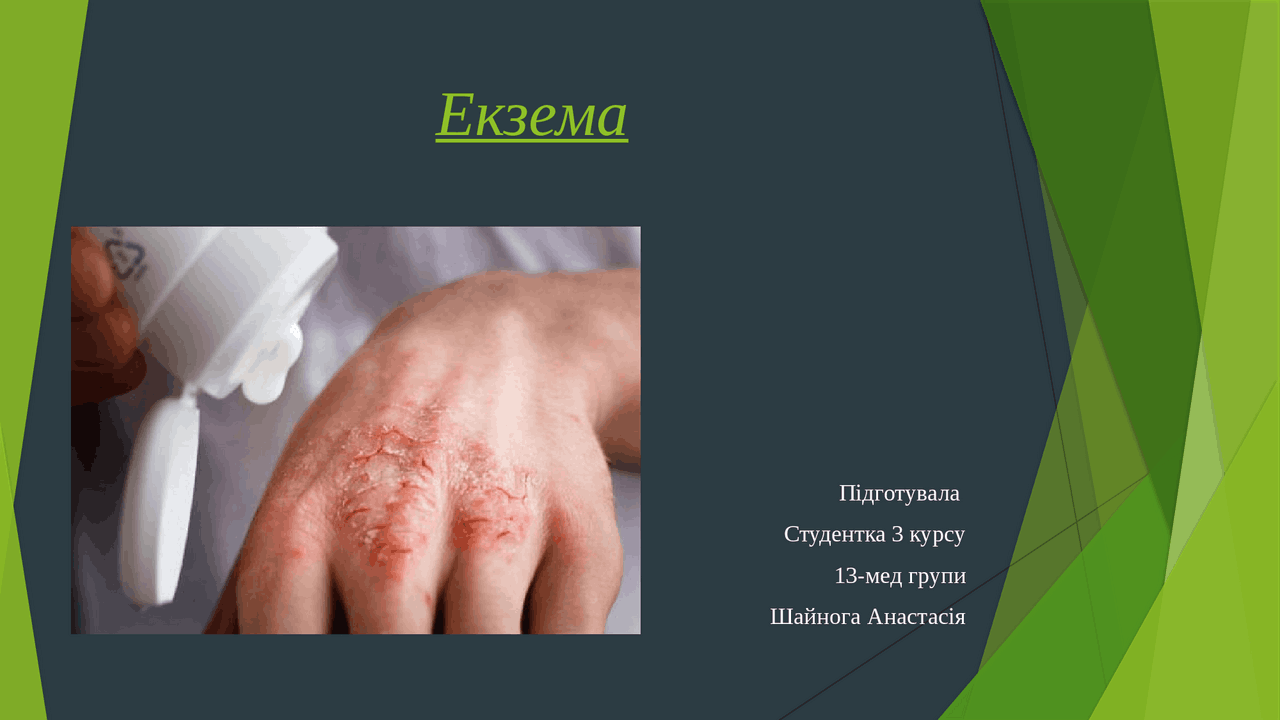 Презентація Екзема педіатрія Презентации Педиатрия Docsity