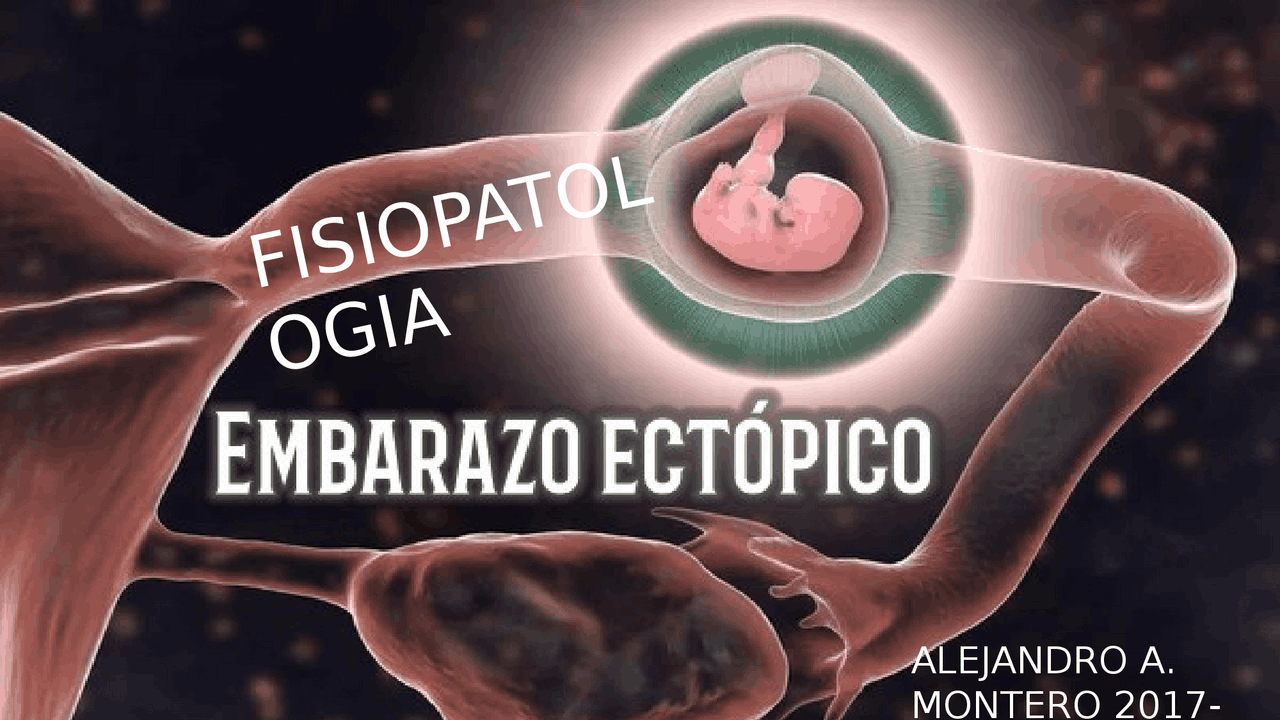 El embarazo comienza con un óvulo fecundado. Normalmente, el óvulo ...
