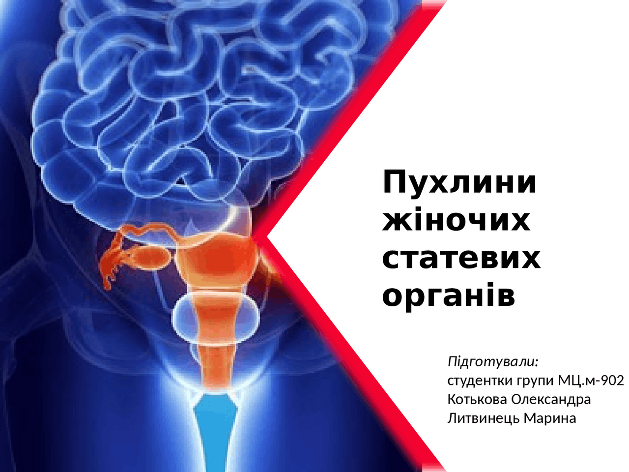 Презентація Пухлини жіночих статевих органів Патоморфологія