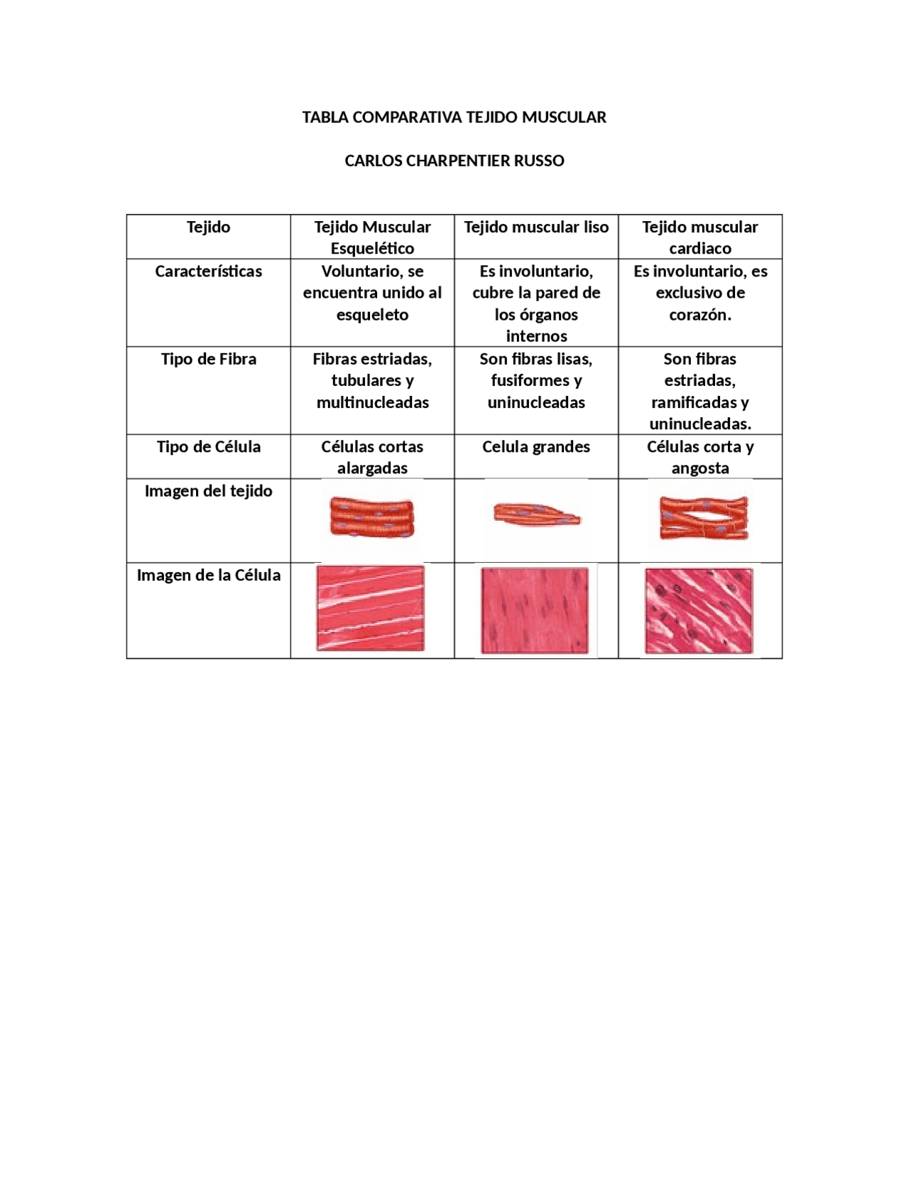 Tejido Muscular Cuadro Comparativo Esquemas Y Mapas Conceptuales De