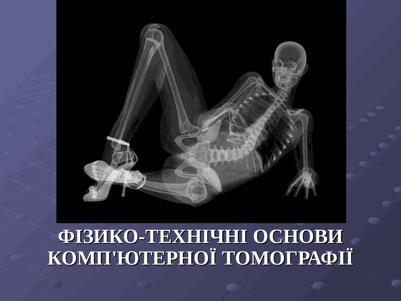 ФІЗИКО ТЕХНІЧНІ ОСНОВИ КОМПЮТЕРНОЇ ТОМОГРАФІЇ Презентации Радиология