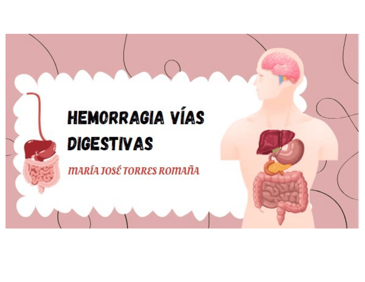Hemorragia De Vías Digestivas Diapositivas De Semiología Docsity