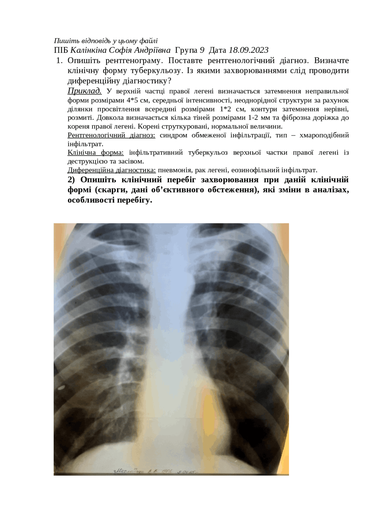 Задачі з фтизіатрії 4 курс Упражнения и задачи Фтизиатрия Docsity