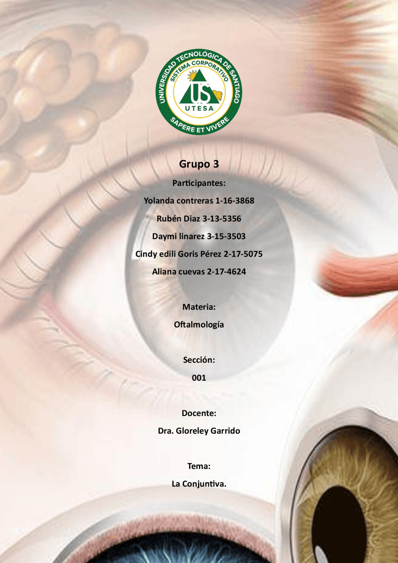 Conjuntiva Que Es Parte Del Ojo Diapositivas De Oftalmología Docsity