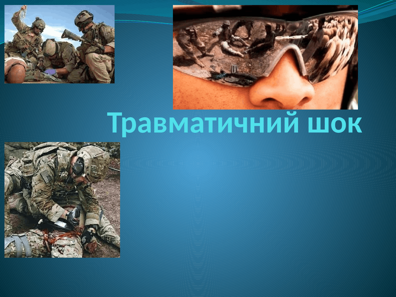 Травматичний шок Презентации Травматология и ортопедия Docsity