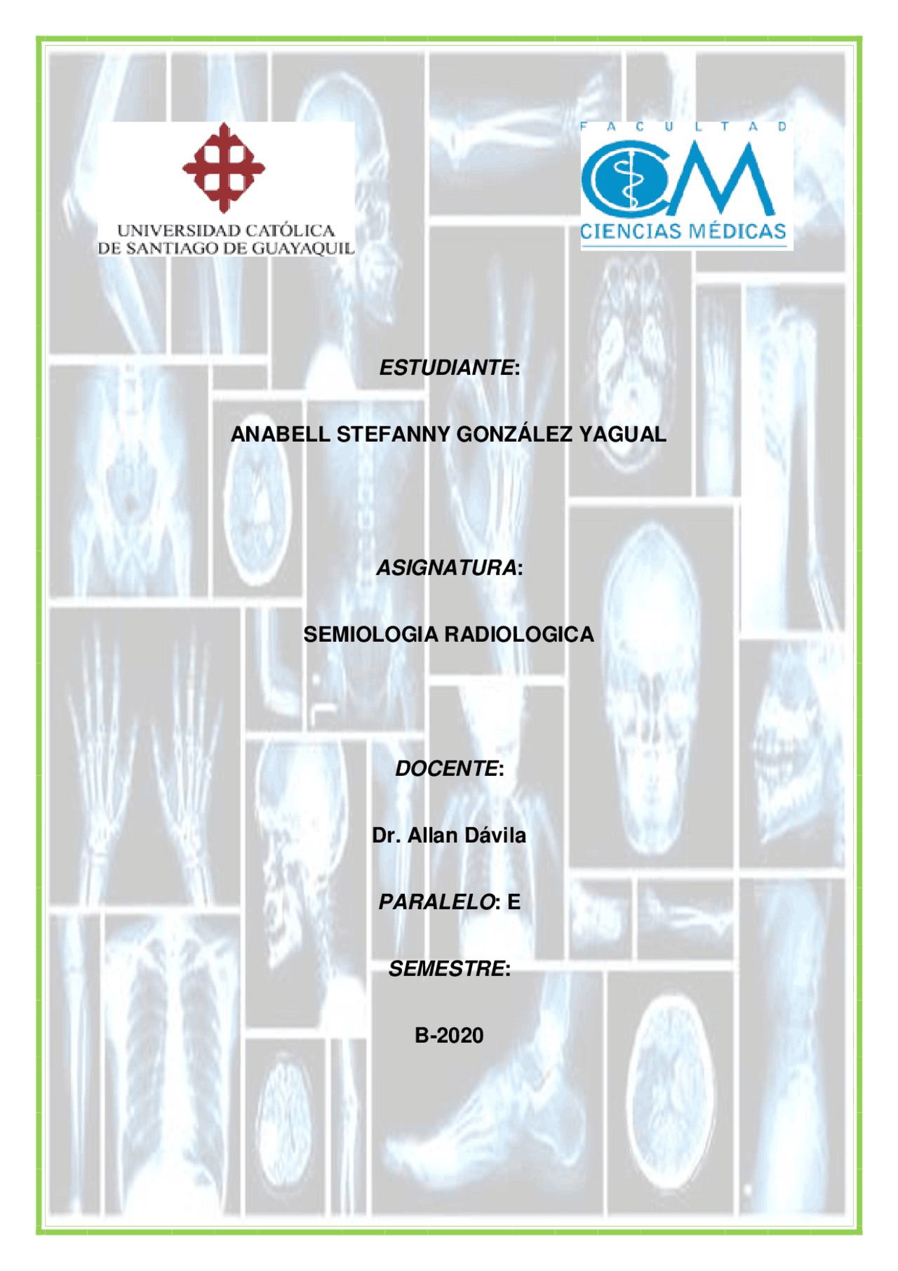 Radiologia Apuntes De Clases Ucsg Apuntes De Radiología Docsity