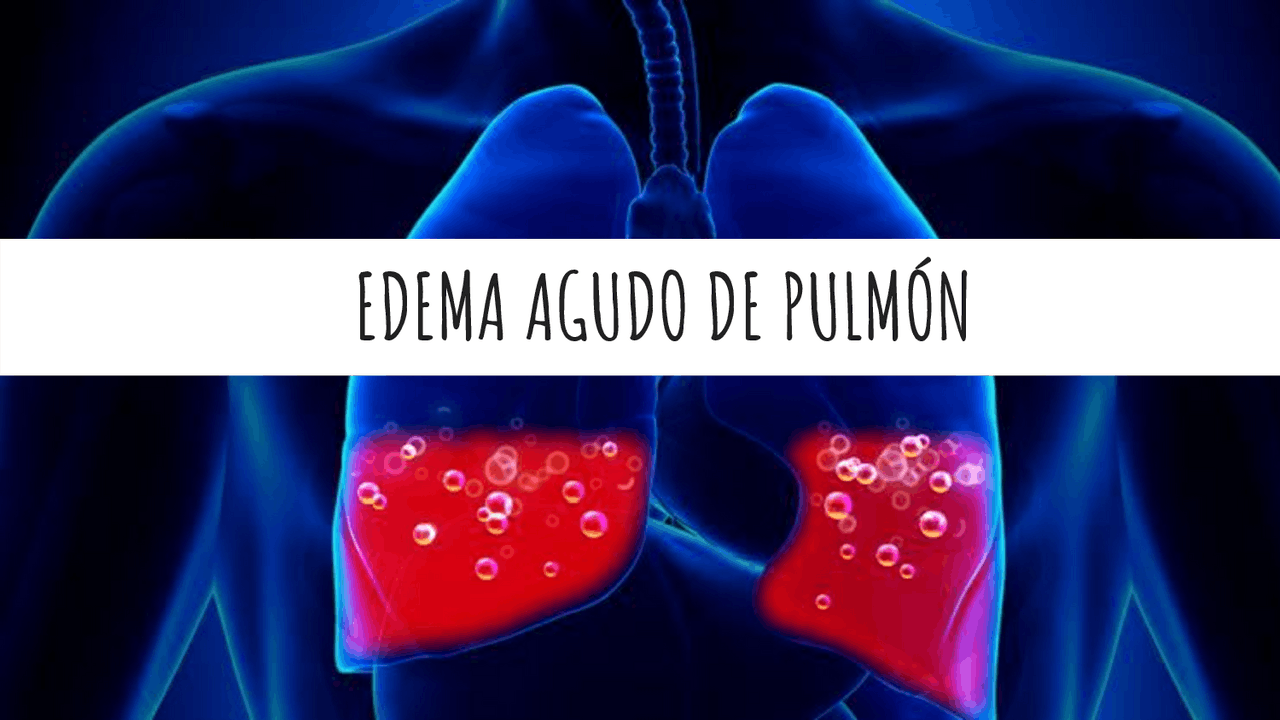 EDEMA AGUDO DE PULMON | Esquemas y mapas conceptuales de Farmacología ...