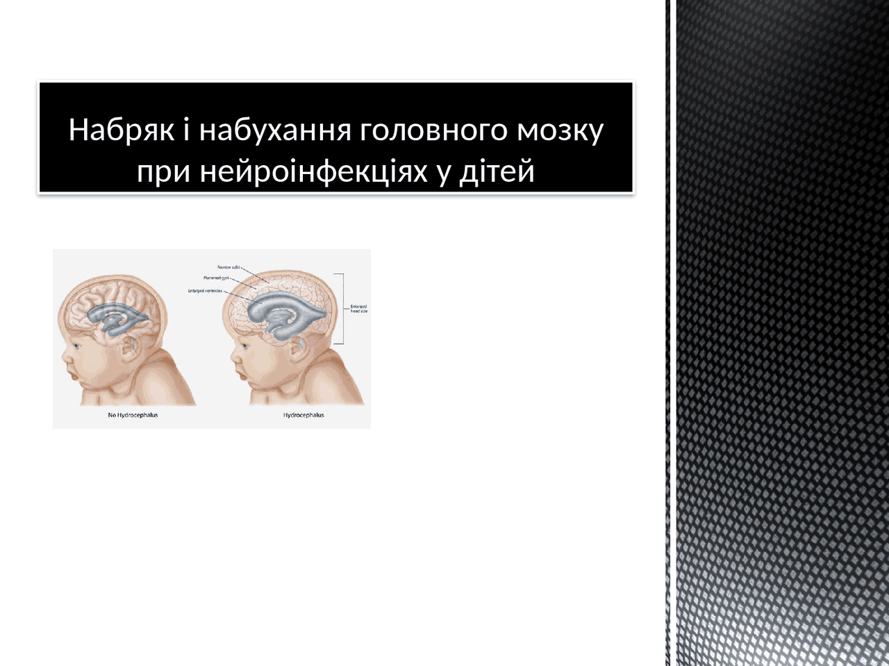 Презентація на тему набряк і набухання головного мозку Упражнения и