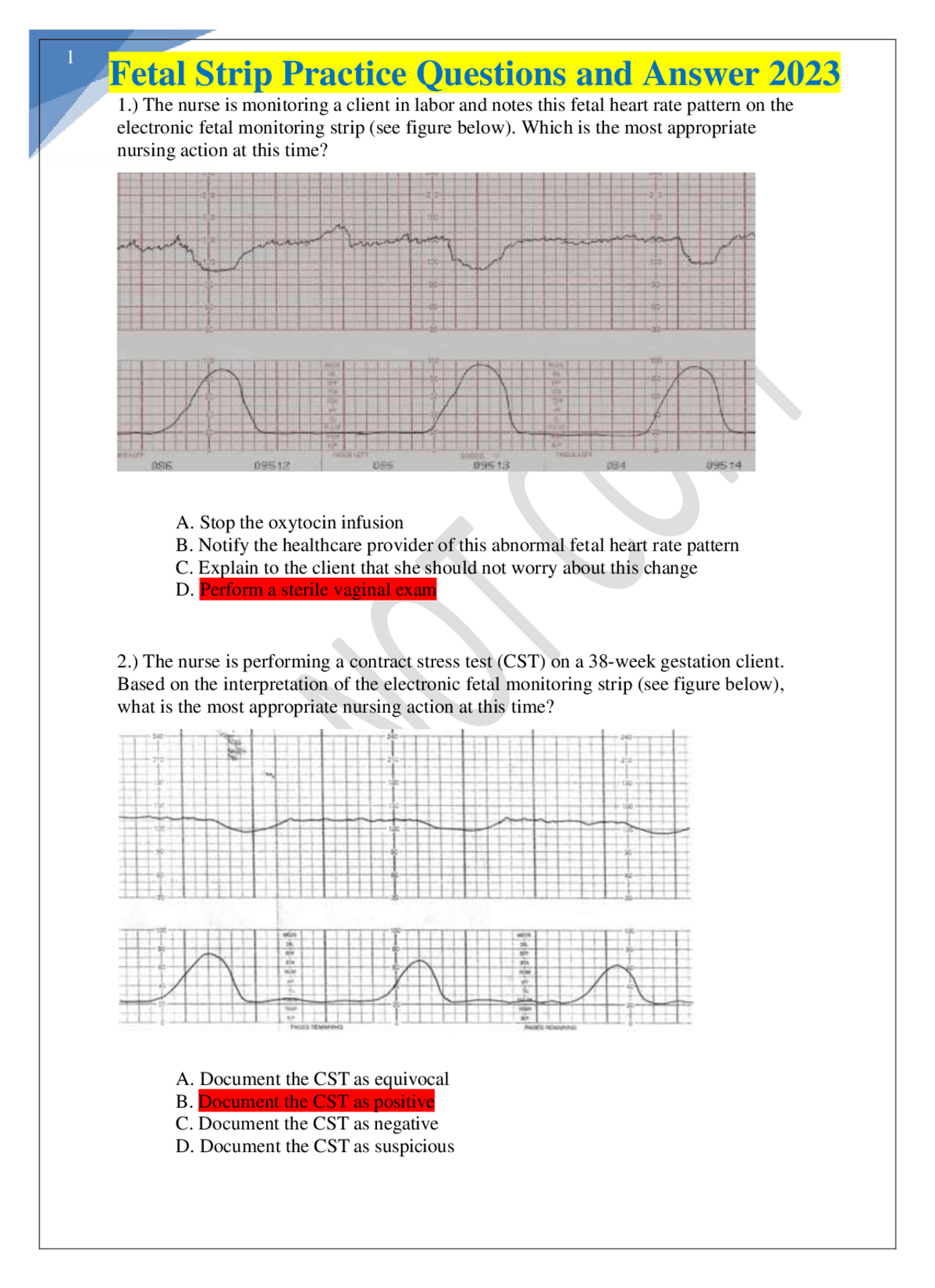 Fetal Strip Practice Questions And Answer 2023 Exams Nursing Docsity