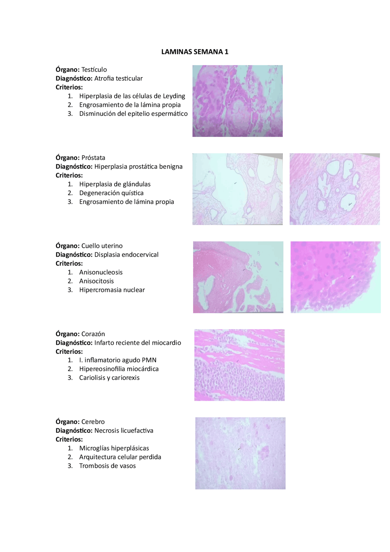 Laminas observadas en el laboratorio | Apuntes de Patología | Docsity
