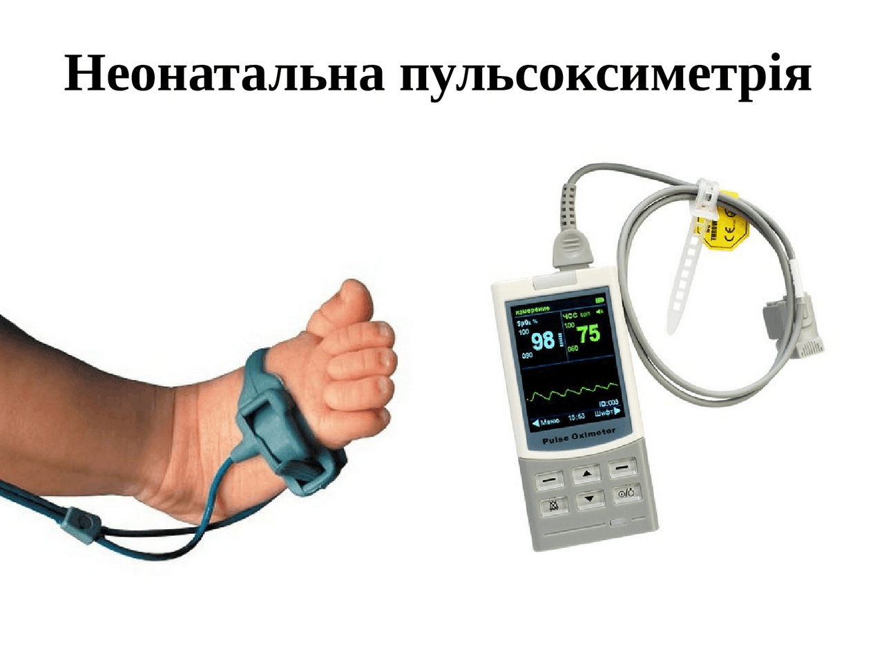 Неонатальна пульсоксиметрія Схемы Педиатрия Docsity